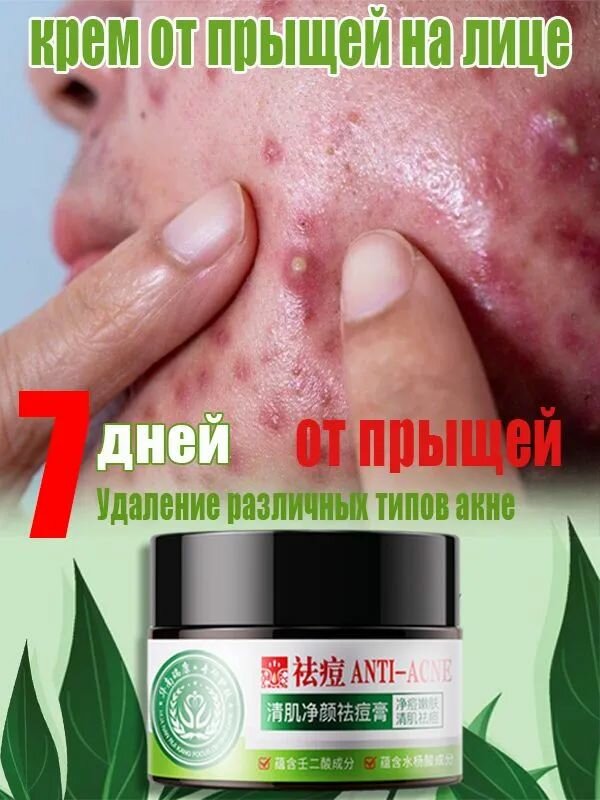 Крем от прыщей для подростков, Борьба с несовершенствами, от прыщей, акне, угрей, увлажняющая и матирующая,30 г