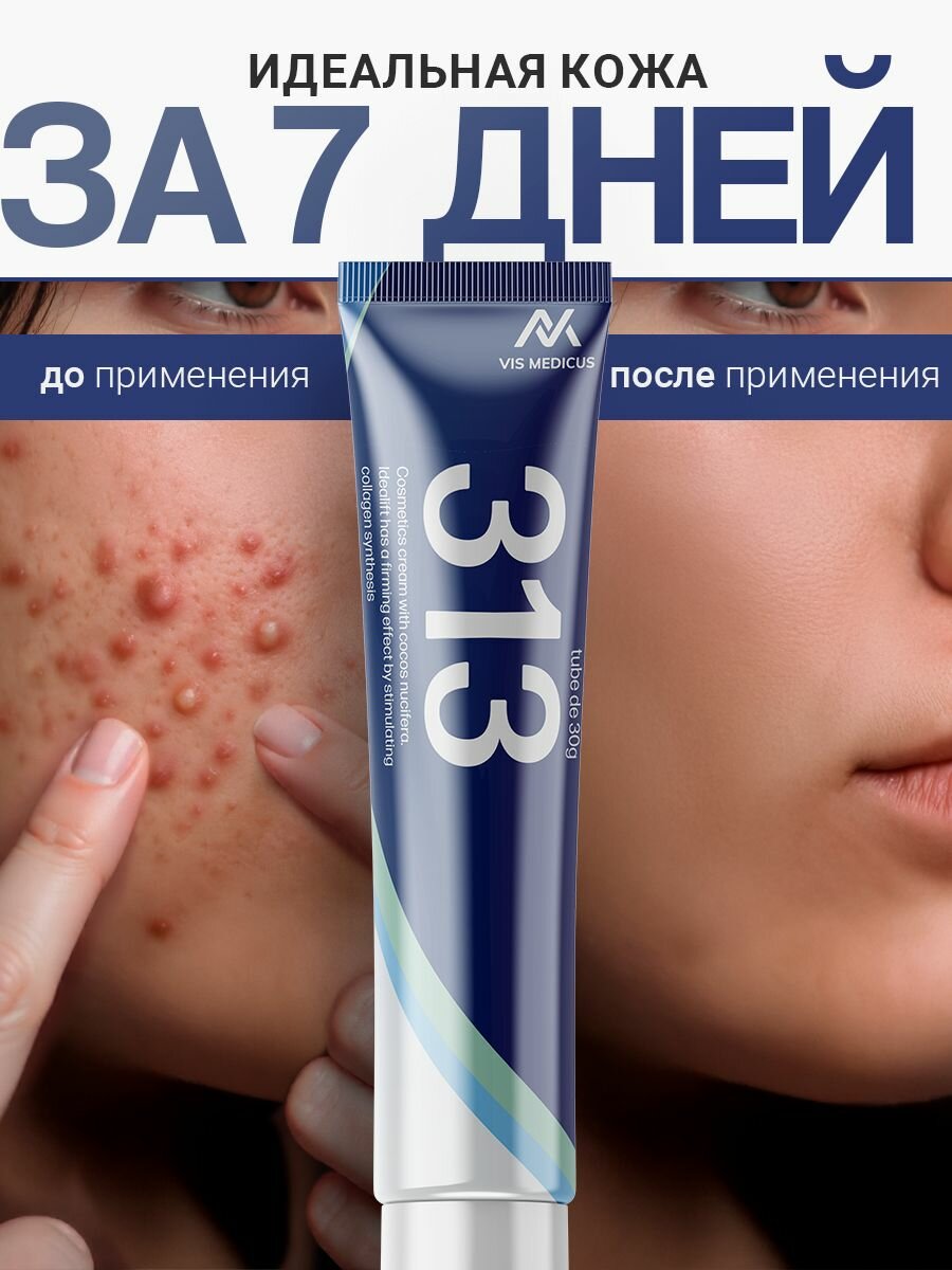 Крем от прыщей для лица 313 / Омолаживающий крем, от акне, от черных точек, крем от прыщей на лице, от пигментации, от угрей / 25 мл