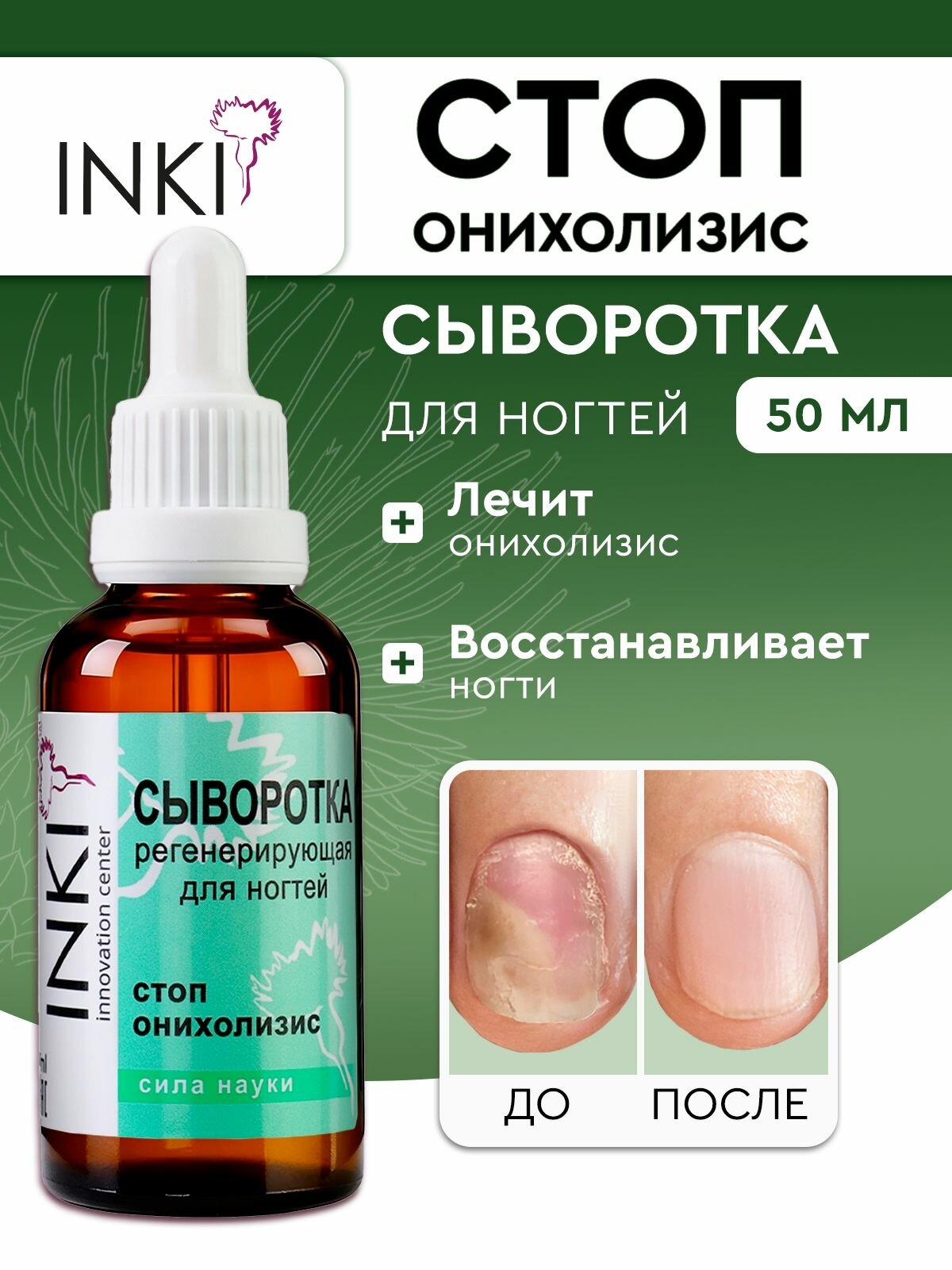 Регенерирующая сыворотка стоп онихолизис для лечения ногтей