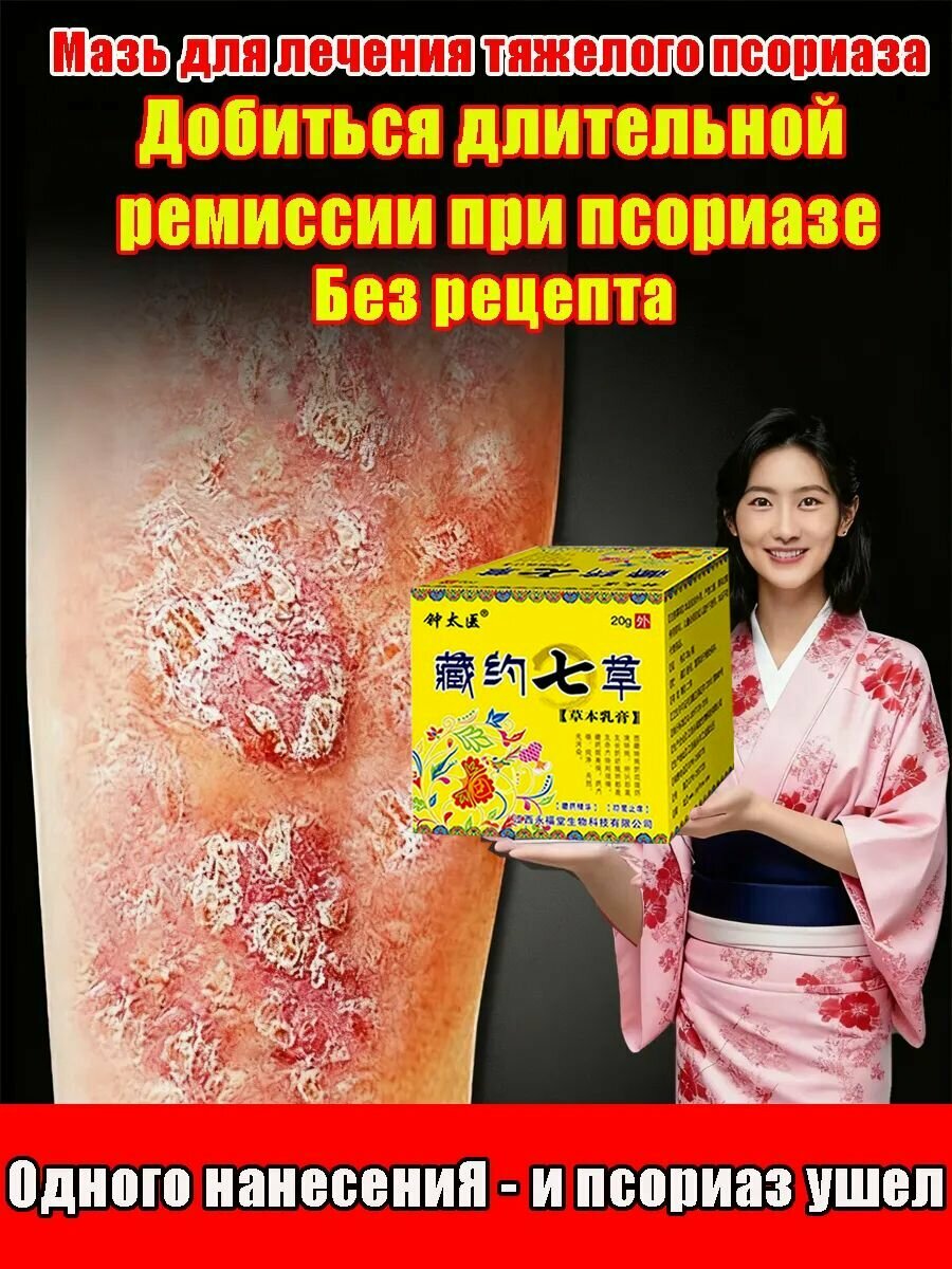 Мазь от псориаза и экземы,20гр