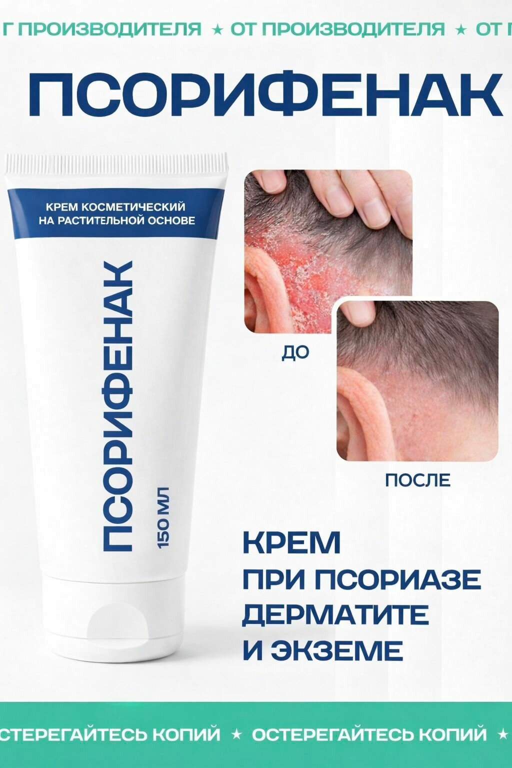 Псорифенак, Крем для лица от дерматита, для тела, от экземы, мазь от псориаза, от прыщей на лице и акне, атопический дерматит, увлажняющий регенерирующий от воспалений, уход за кожей