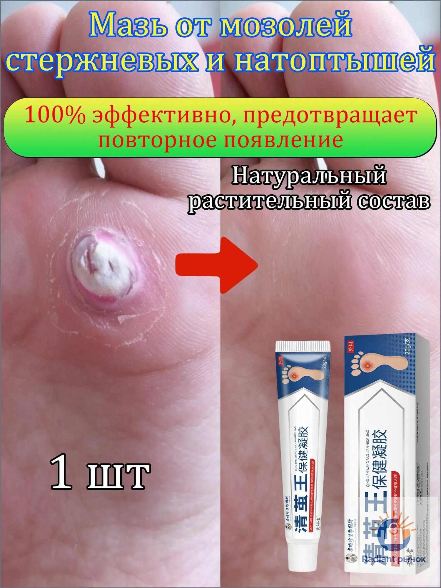 Mазь от мозолей стержневых и натоптышей , Крем от сухих мозолей, шипицы, бородавок, натоптышей,20 г 1 шт.
