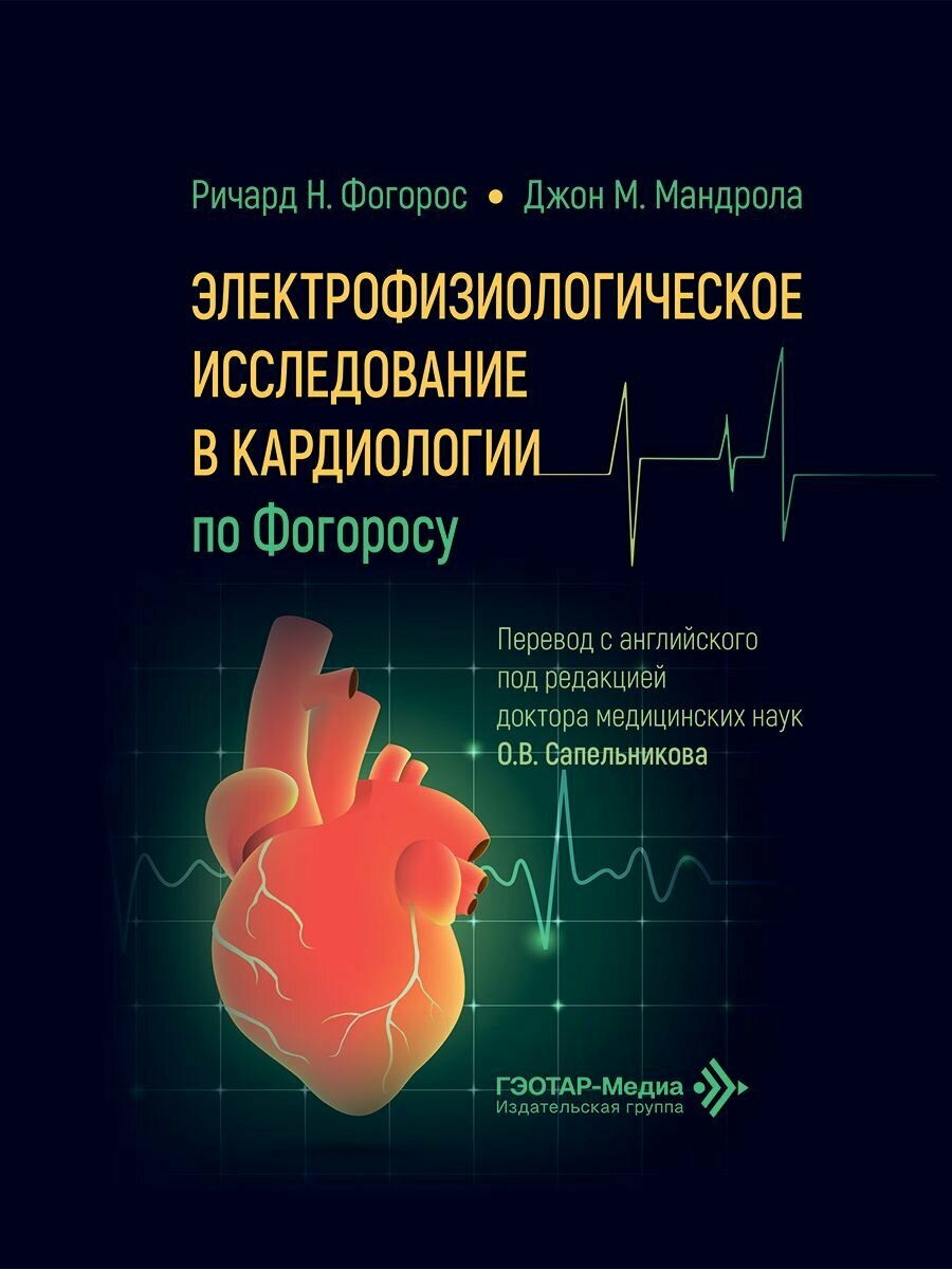 Электрофизиологическое исследование в кардиологии по Фогоросу