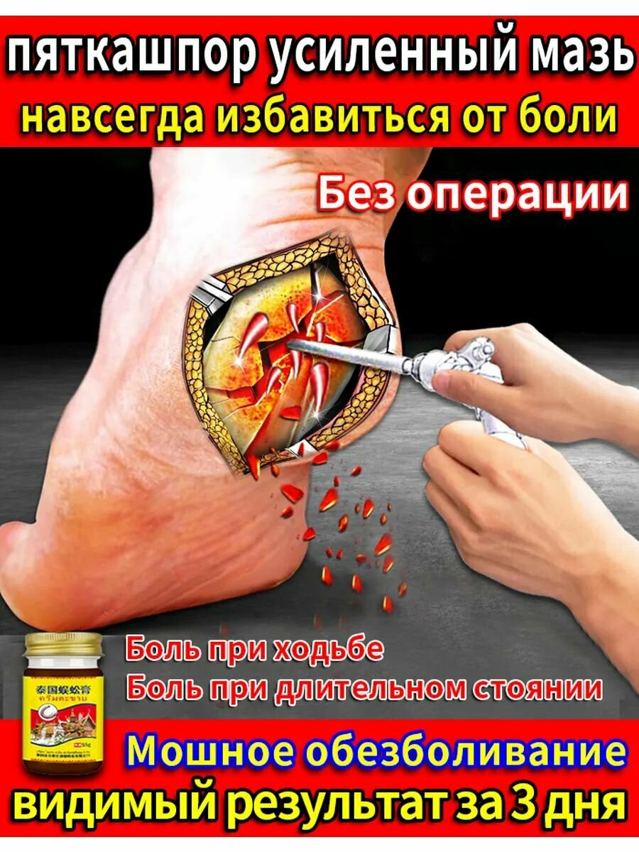 Крем для ног "Пяткашпор Усиленный" от пяточной шпоры 55 г-HAIJI-haojiataihe