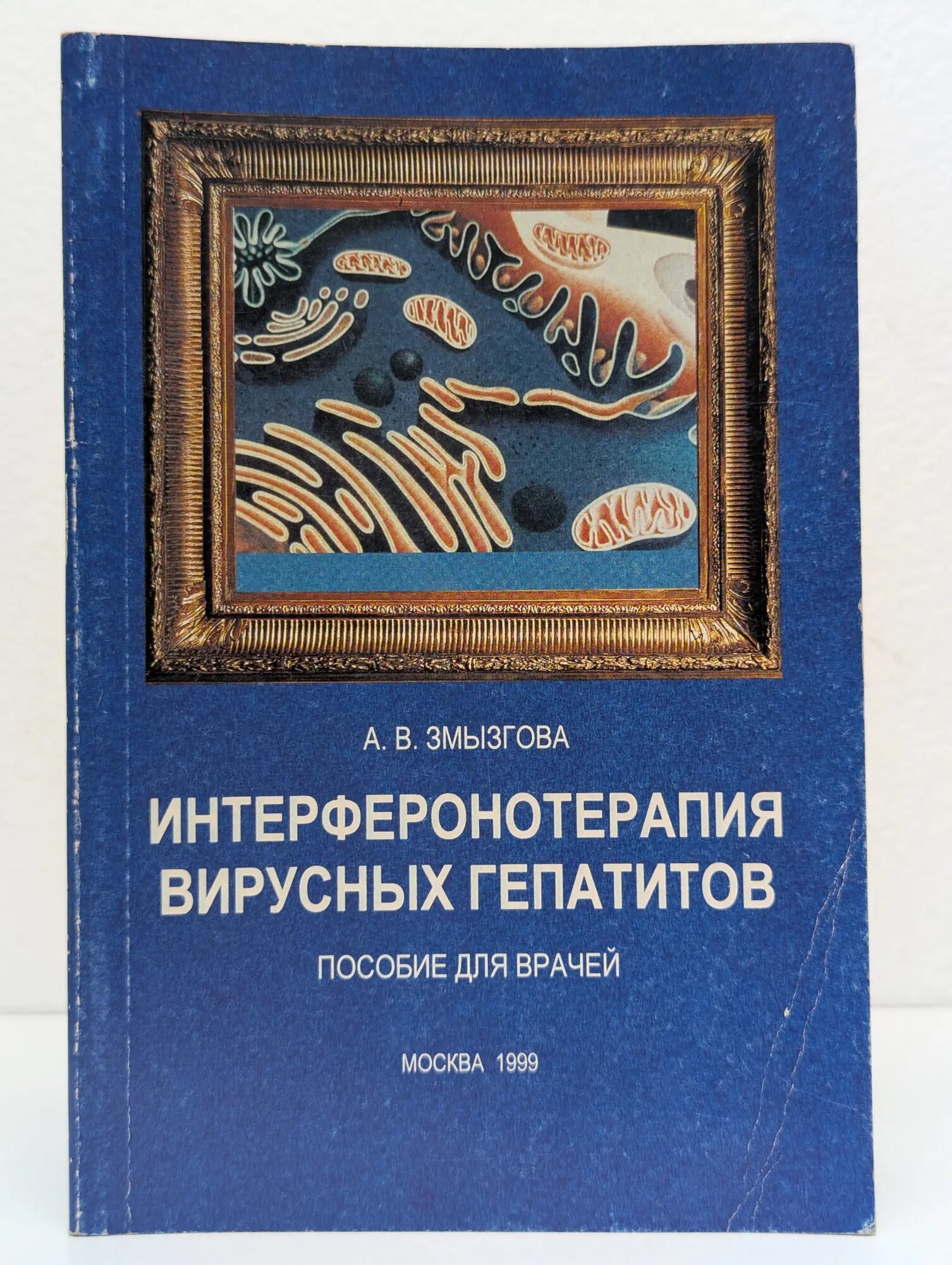 Интерферонотерапия вирусных гепатитов Змызгова Анна Васильевна 1999