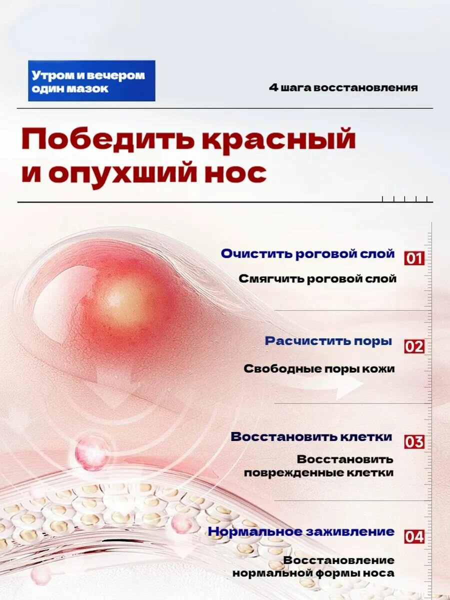 DTMS Сыворотка для лица с азелаиновой кислотой 10% и скваланом от прыщей, восстанавливающий крем, винная мазь орозацеа розацеа, 20г