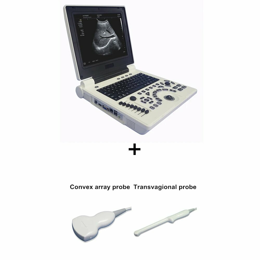 NESWELLMED Портативный ультразвуковой сканер USG Европейская вилка (EU Plug), convex-transvagional