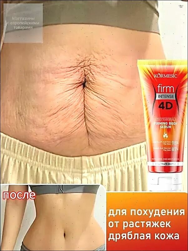 Эксклюзивный антицеллюлитный крем для моделирования тела, коррекции растяжек и упругости кожи