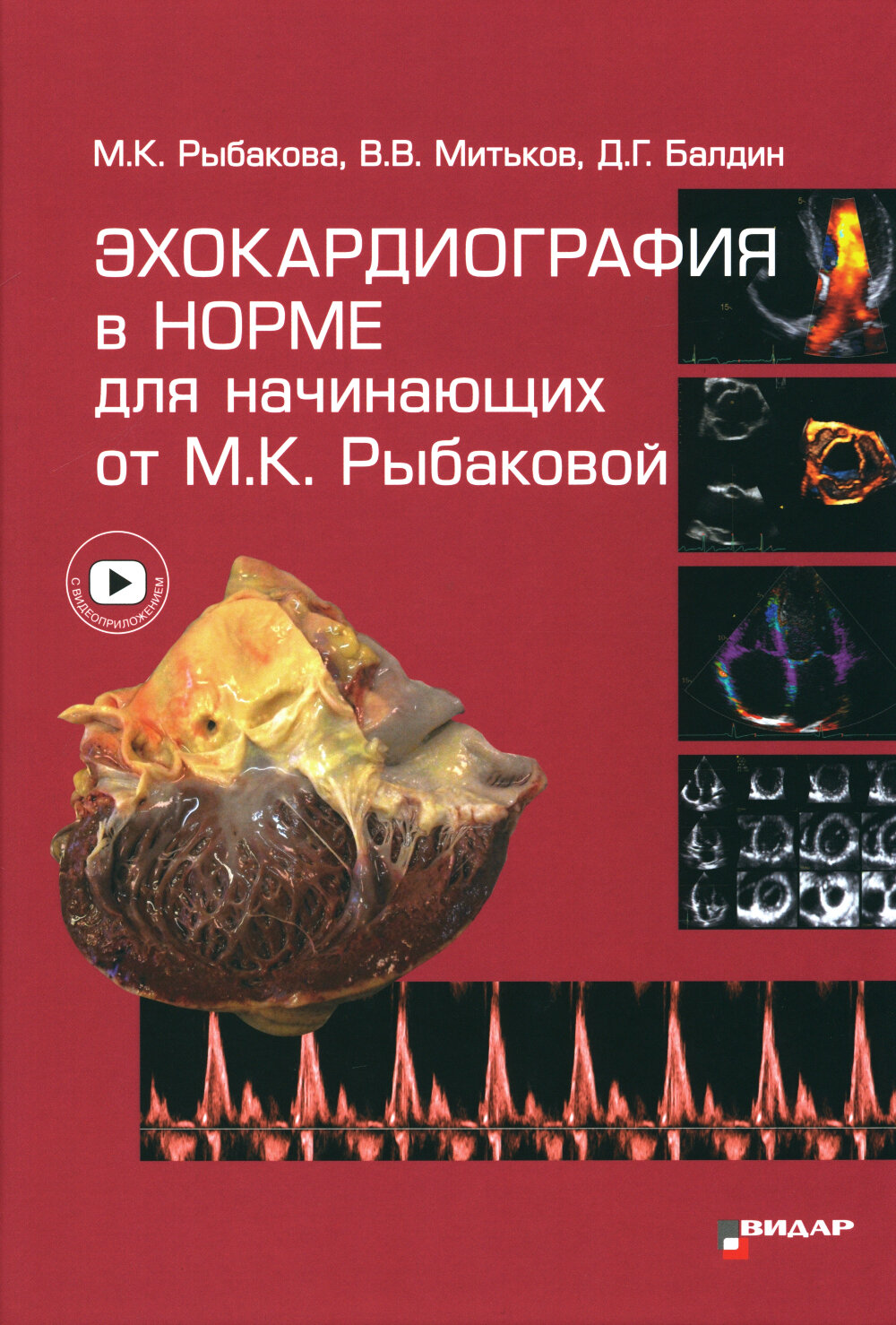 Уценка Эхокардиография в норме для начинающих от М.К. Рыбаковой. Рыбакова М.К., Митьков В.В., Балдин Д.Г.