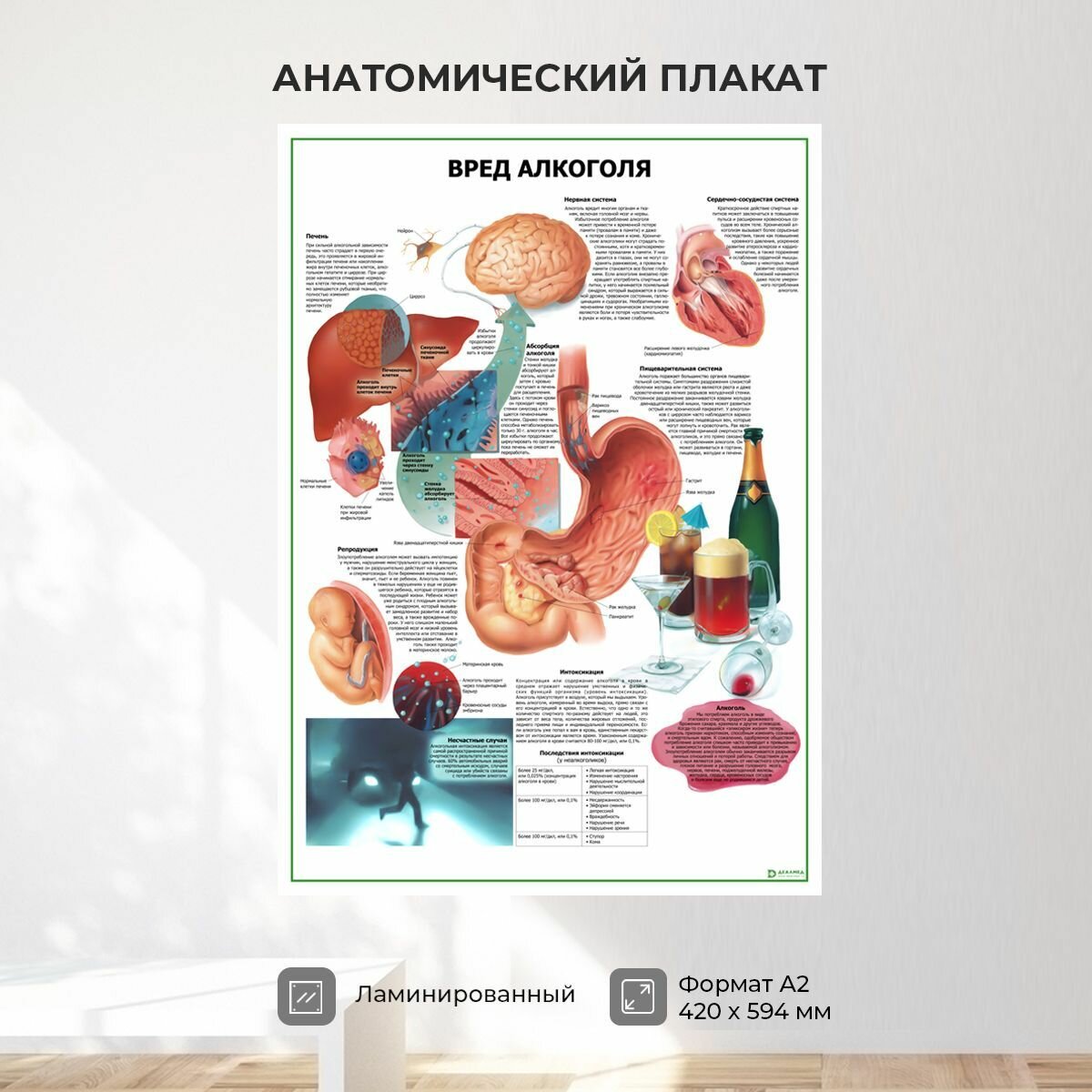 Обучающий медицинский плакат анатомия Вред алкоголя А2
