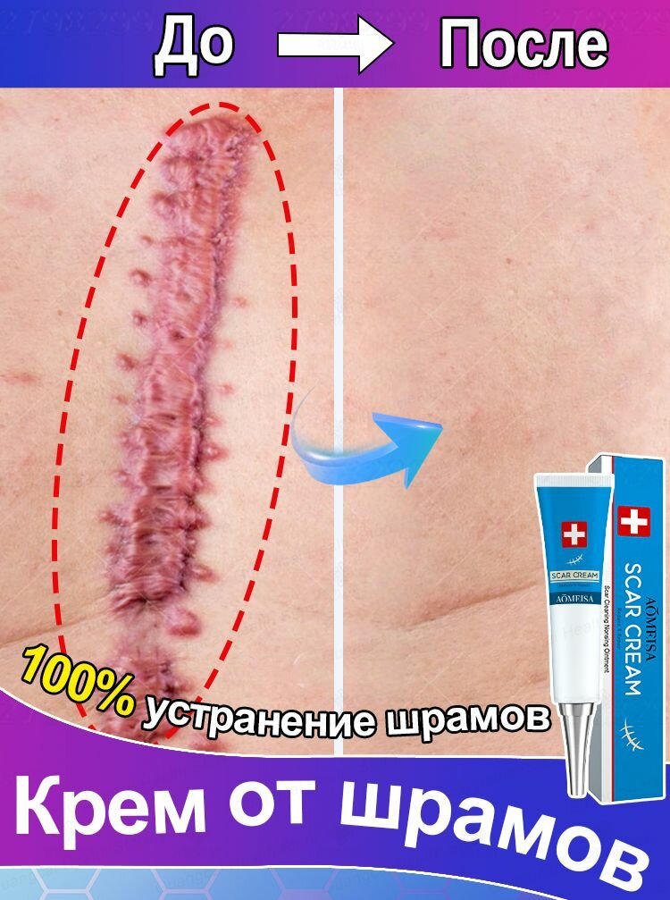 Гель от рубцов, крем-гель от рубцов, растяжек, травм и пигментации, борется с угрями, прыщами, акне и следами постакне