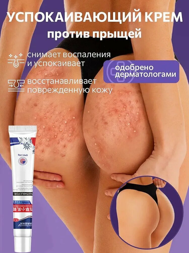 Точечный крем от прыщей , крем от прыщей на ягодицах, Крем для лица и тела, прыщ, для проблемной кожи, увлажнение,20 г
