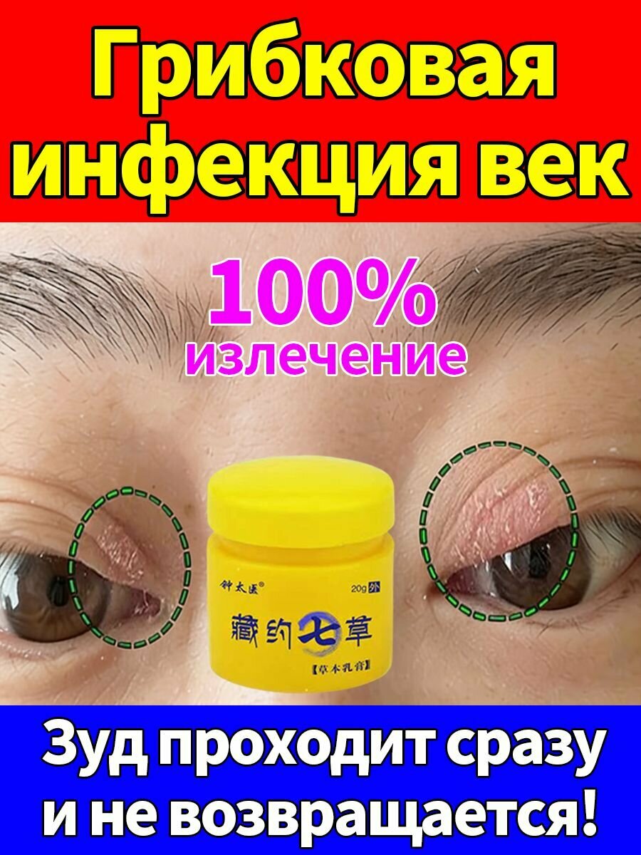 Мазь от зуда при диабете Снимает раздражение, увлажняет 20 г