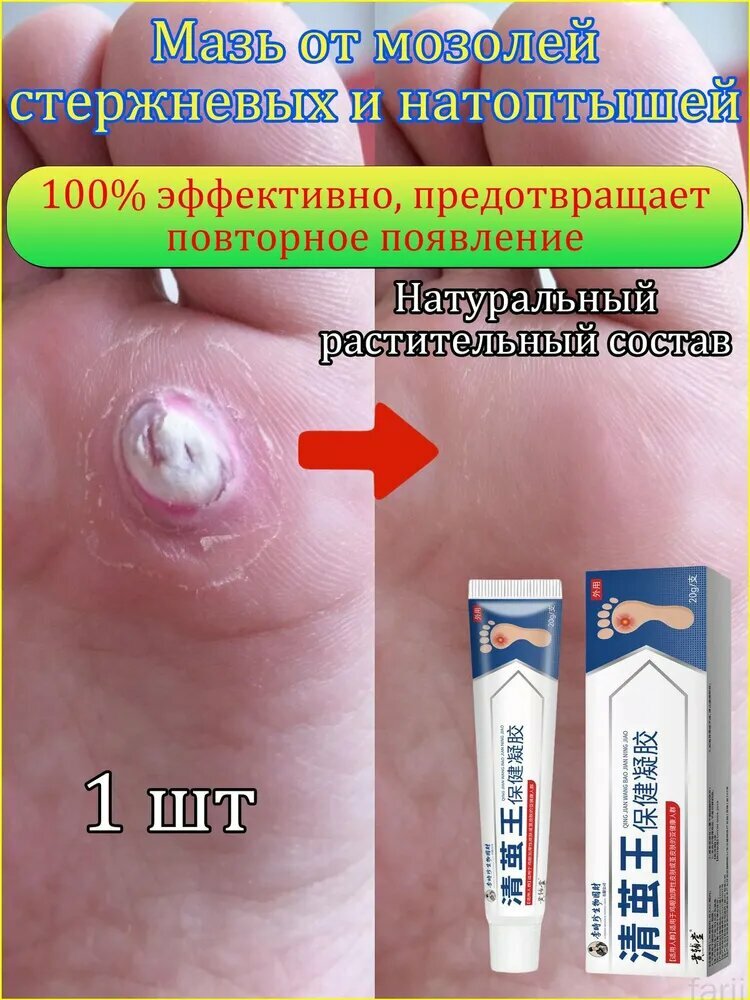 Крем против сухих натоптышей и шипицы, мазь от бородавок и стержневых мозолей, 20 г, 1 упаковка, качественный состав
