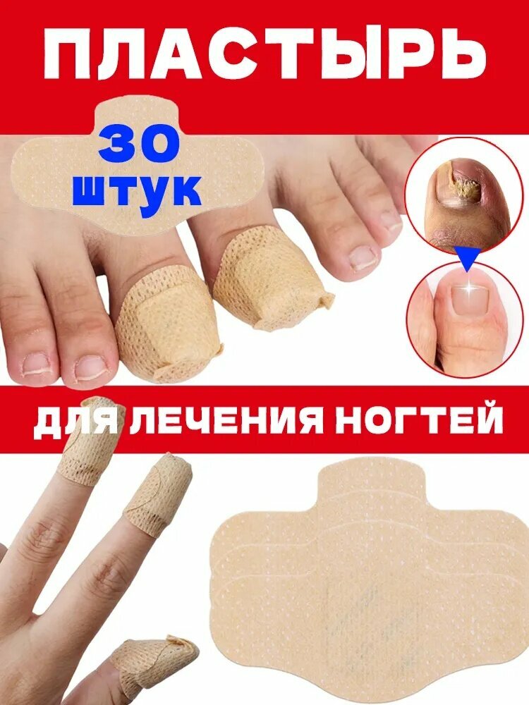 1 коробка/30 штук Пластырь для лечения ногтей для борьбы с грибком, коррекции ногтей