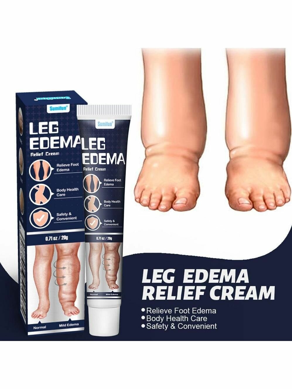 Мазь для снятия отека ног