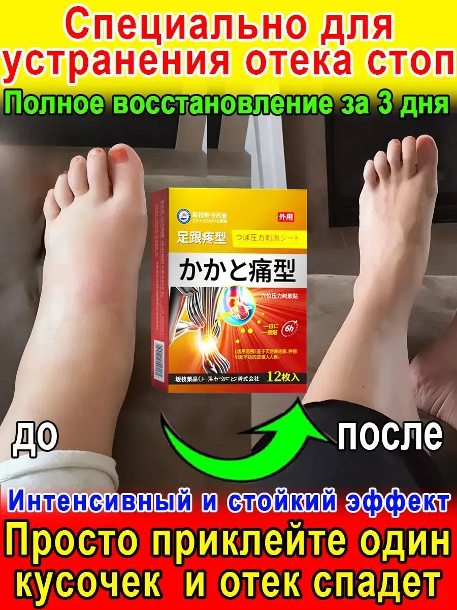 Патчи для ног от отеков тяжести и давления 12 шт - снятие усталости и улучшение кровообращения