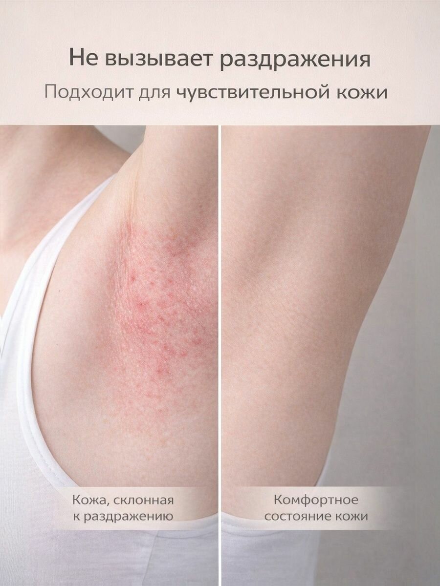 U&I Дезодорант 135 мл — фото 1