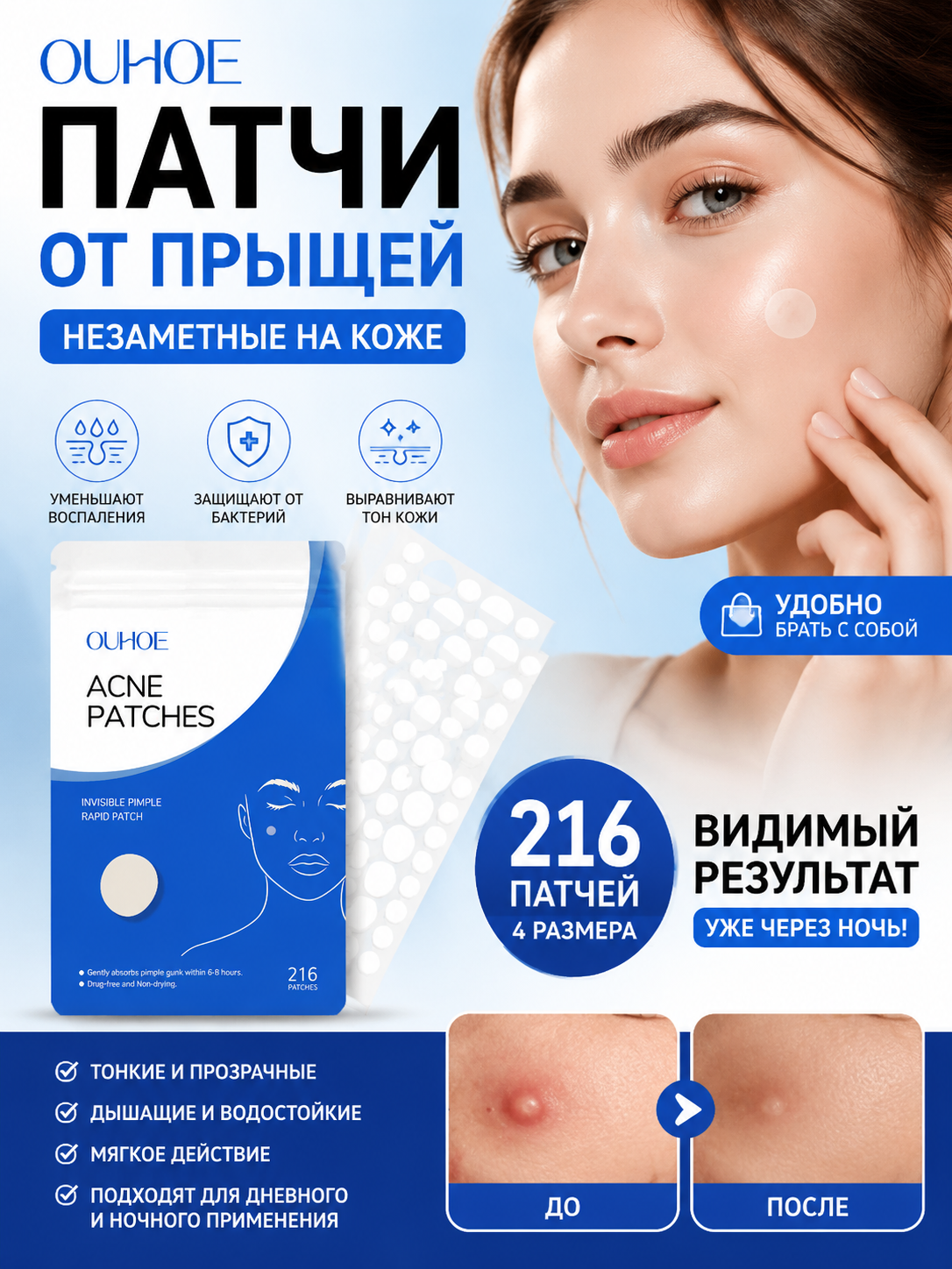 OUHOE acne Patch нежный уход за кожей лица ежедневный пластырь для ухода за акне портативный 216шт