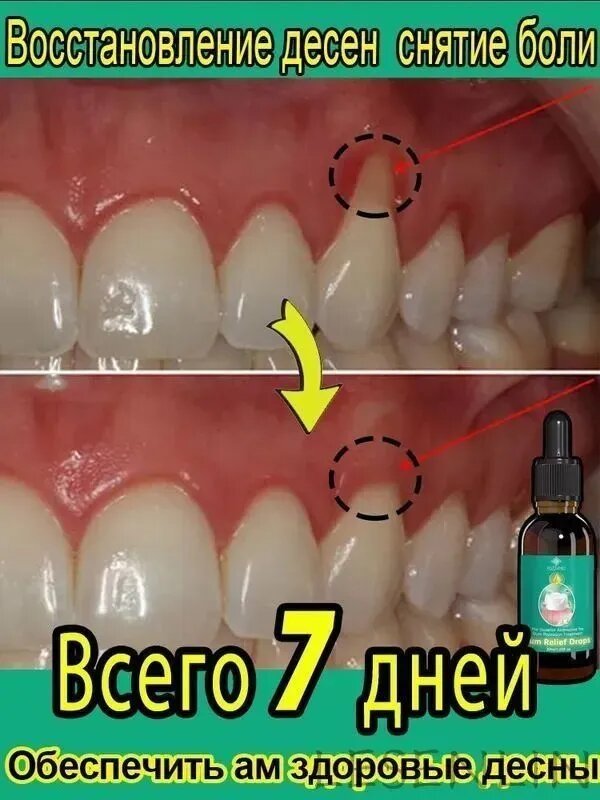 Эфирное масло для ухода за полостью рта при рецессии десен, чувствительных зубах и деснах. Растительные экстракты. Антибактериальное средство для ухода за полостью рта. 90 мл.