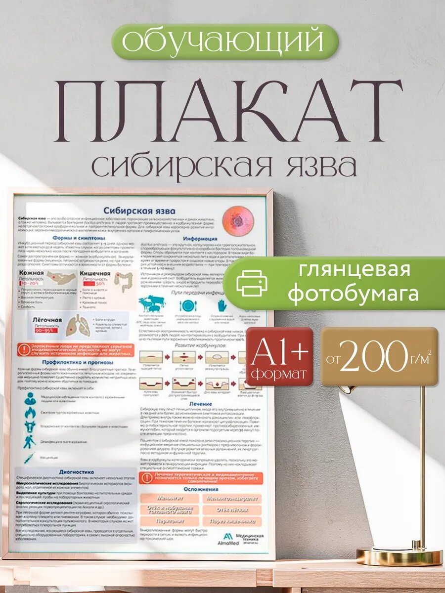 Обучающий плакат "Сибирская язва", размер А1+, глянцевая фотобумага от 200г/м2