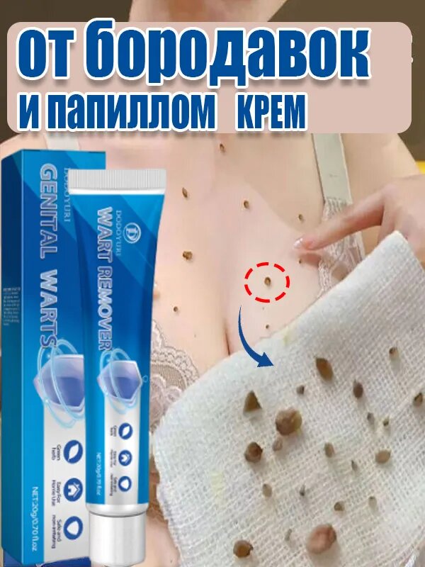 Средство от папиллом, Мазь от бородавок и папиллом на руках и лице без побочных эффектов.20 мл