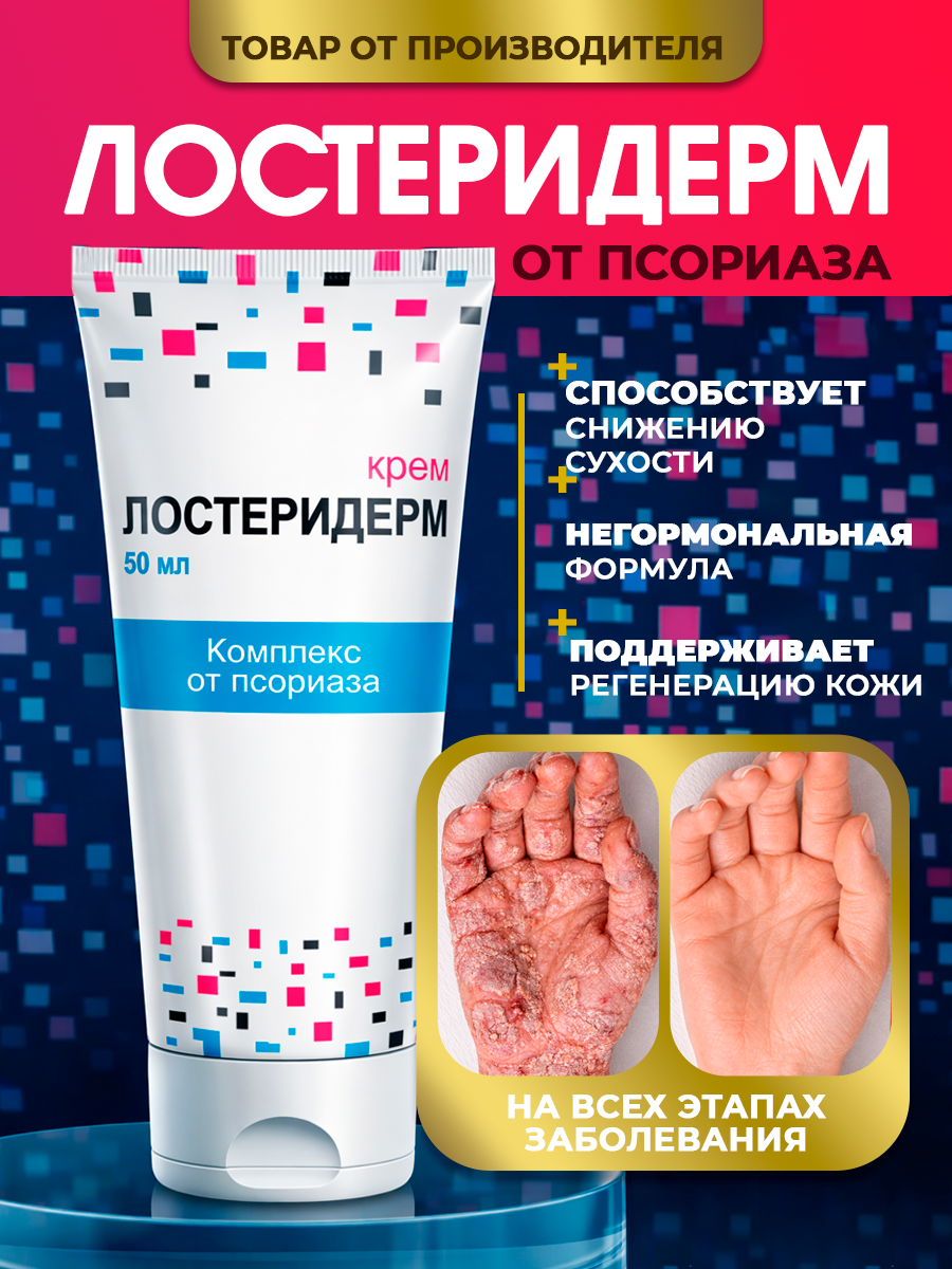 Лостеридерм: крем-мазь для ухода за кожей при псориазе, сухой и чувствительной коже, натуральный состав, 50 мл