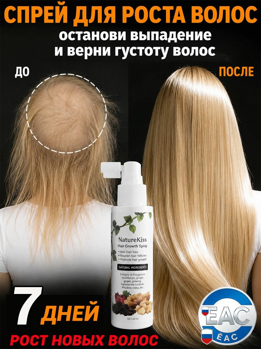 Спрей для роста волос/Предотвращает выпадение волос, укрепление корней, активирует фолликулы, уход за кожей головы, для мужчин и женщин,60 мл