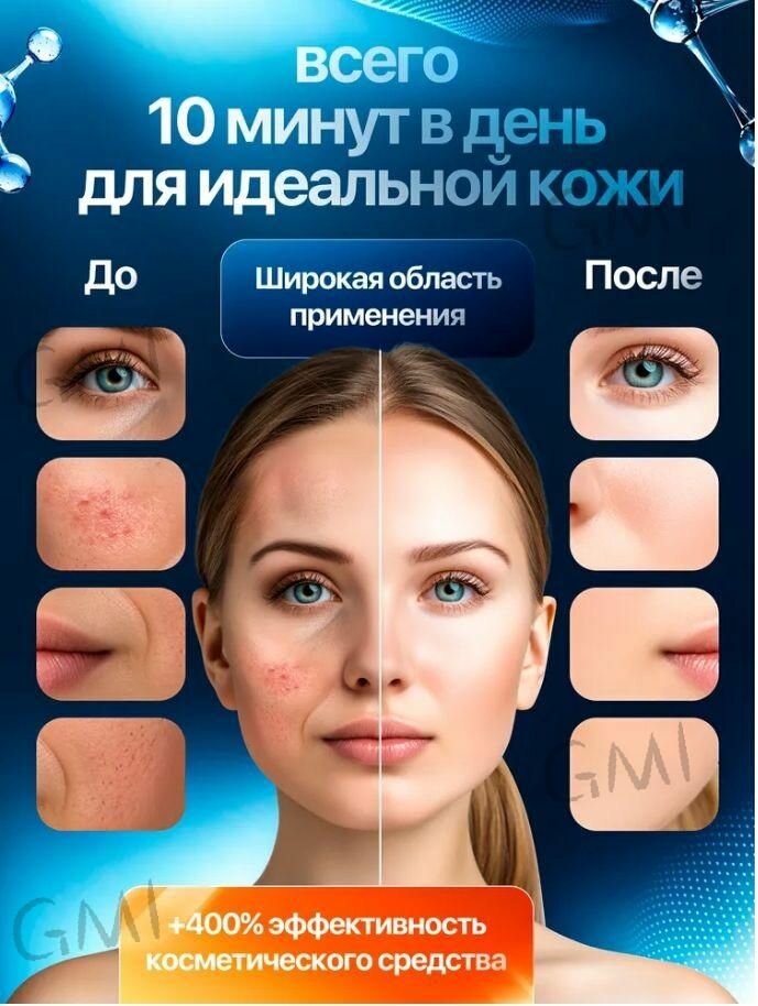 Электромассажер для лица — фото 1