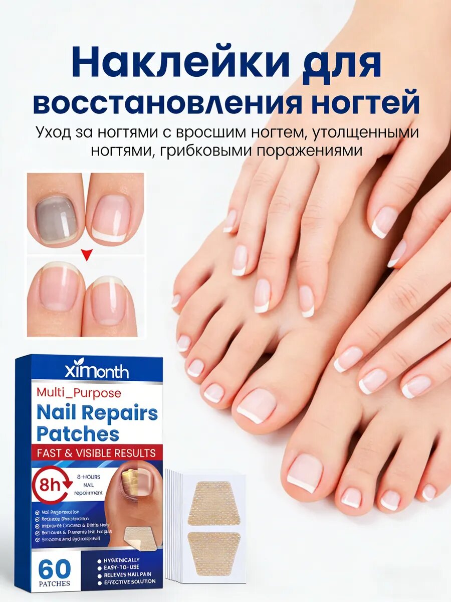 Пластырь от грибка ногтей на ногах, Утолщение мягкой инкрустации ногтей на руках и ногах, наклейки для ухода за ногтями