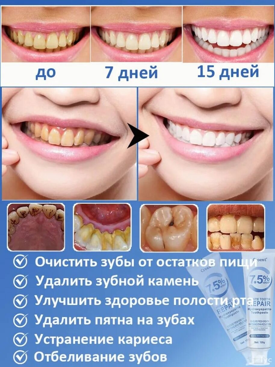 Эксклюзивная паста для чувствительных зубов 120 г с гидроксиапатитом, обеспечивающая бережное отбеливание и укрепление эмали