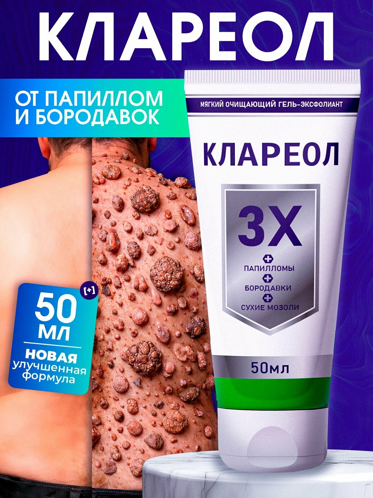 Крем-гель Клареол от папиллом, бородавок и сухих мозолей, чистотел от папиллом, 50 мл