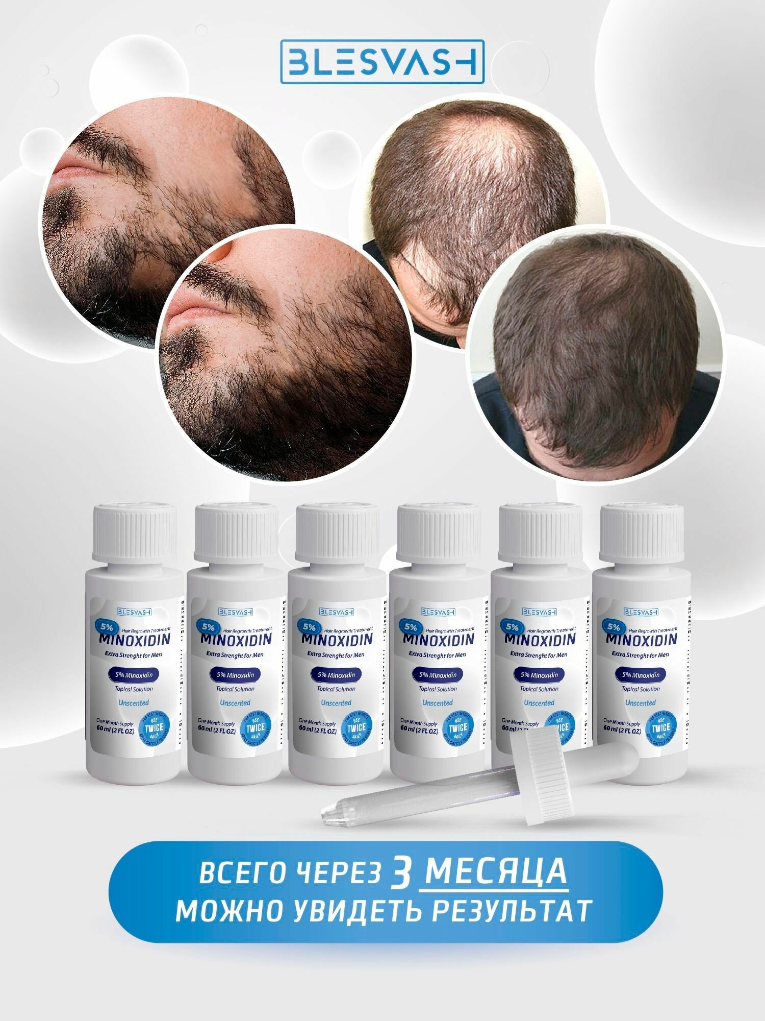 Лосьон для волос