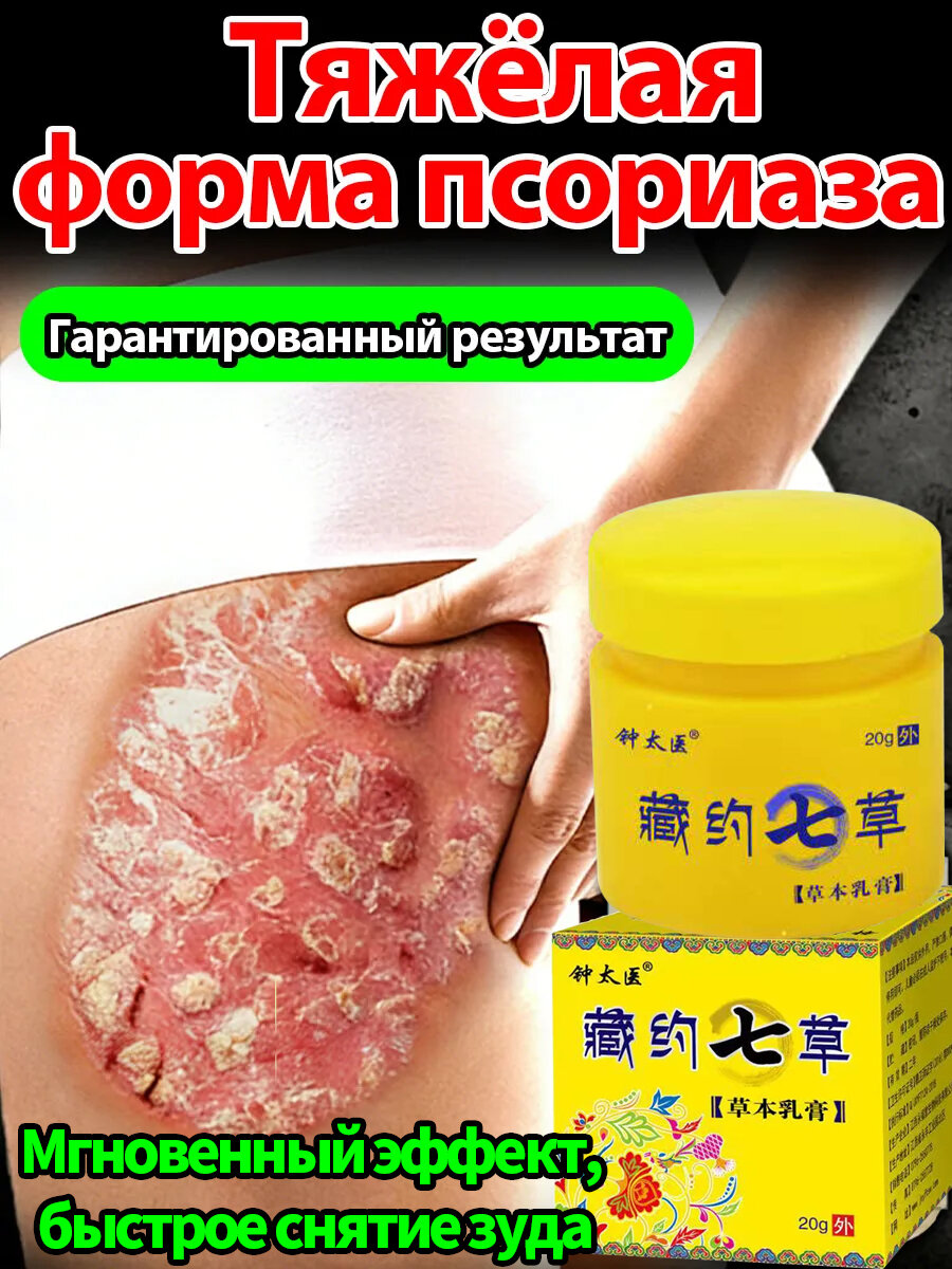 Негормональная мазь от грибковых заболеваний, псориаза, лишая, экземы, акне, 20г