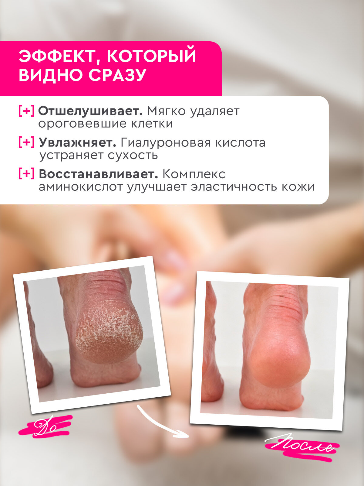 Скраб пилинг для ног, средство от натоптышей и мозолей для гладких пяток