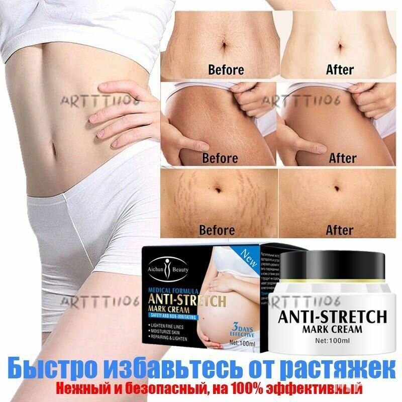 Крем от растяжек 100 г, для беременных женщин после родов шрамы на коже живота профилактика беременности питательный увлажняющий крем для ухода за кожейeNnML