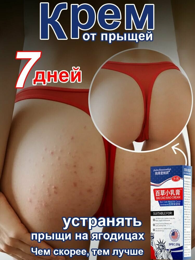 Мазь от прыщей на попе, Китайская Чудо мазь/20 мл , Устранение Прыщи на ягодицах, прыщи на волосяных фолликулах для противозудом