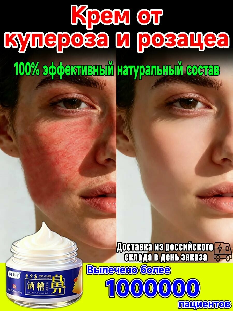 Мазь от Китайский розацеа на лице купероза и покраснений