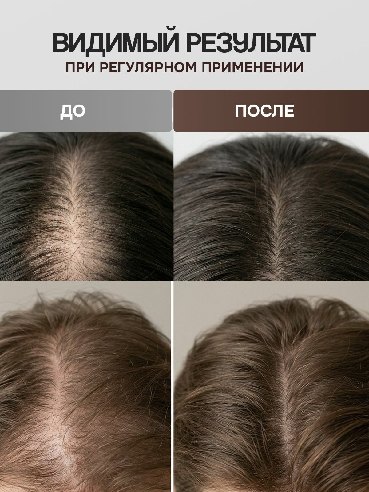 Сыворотка для роста волос — фото 1