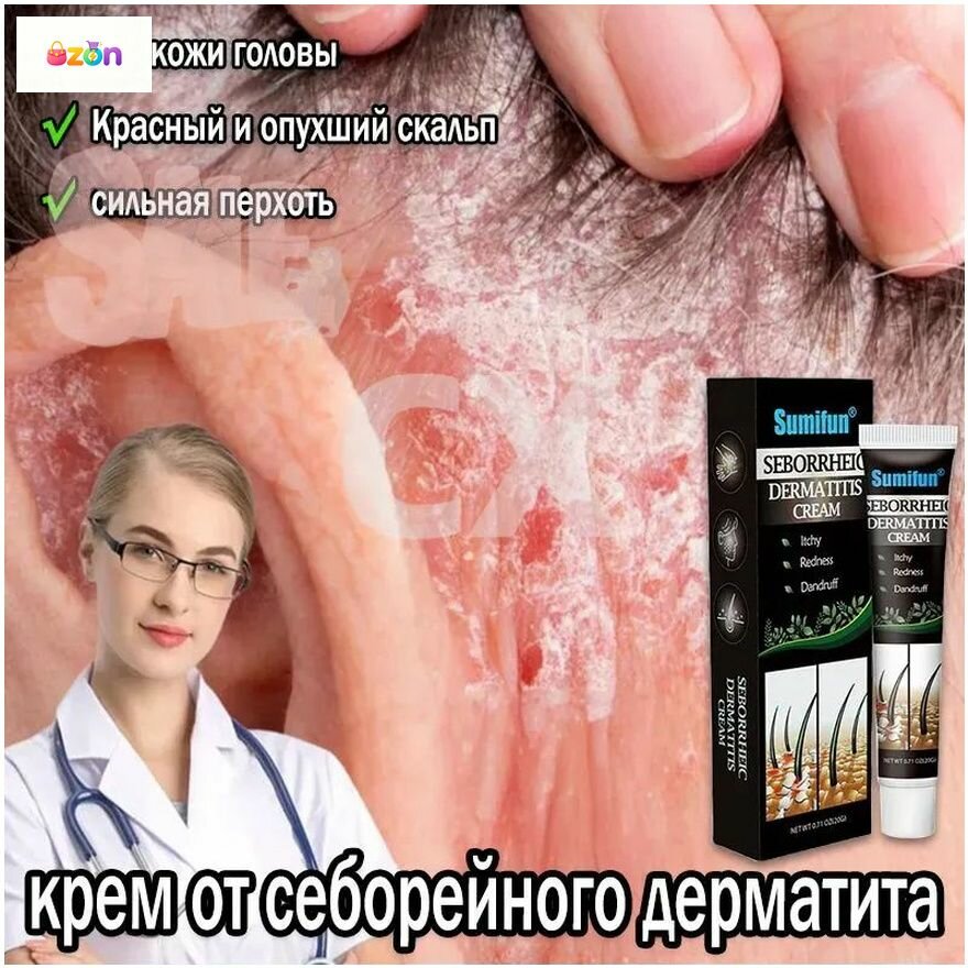 Крем от дерматита, для лечения себорейного дерматита, псориаза, шелушения и зуда для тела, для кожи головы, тела и лица, 20 г
