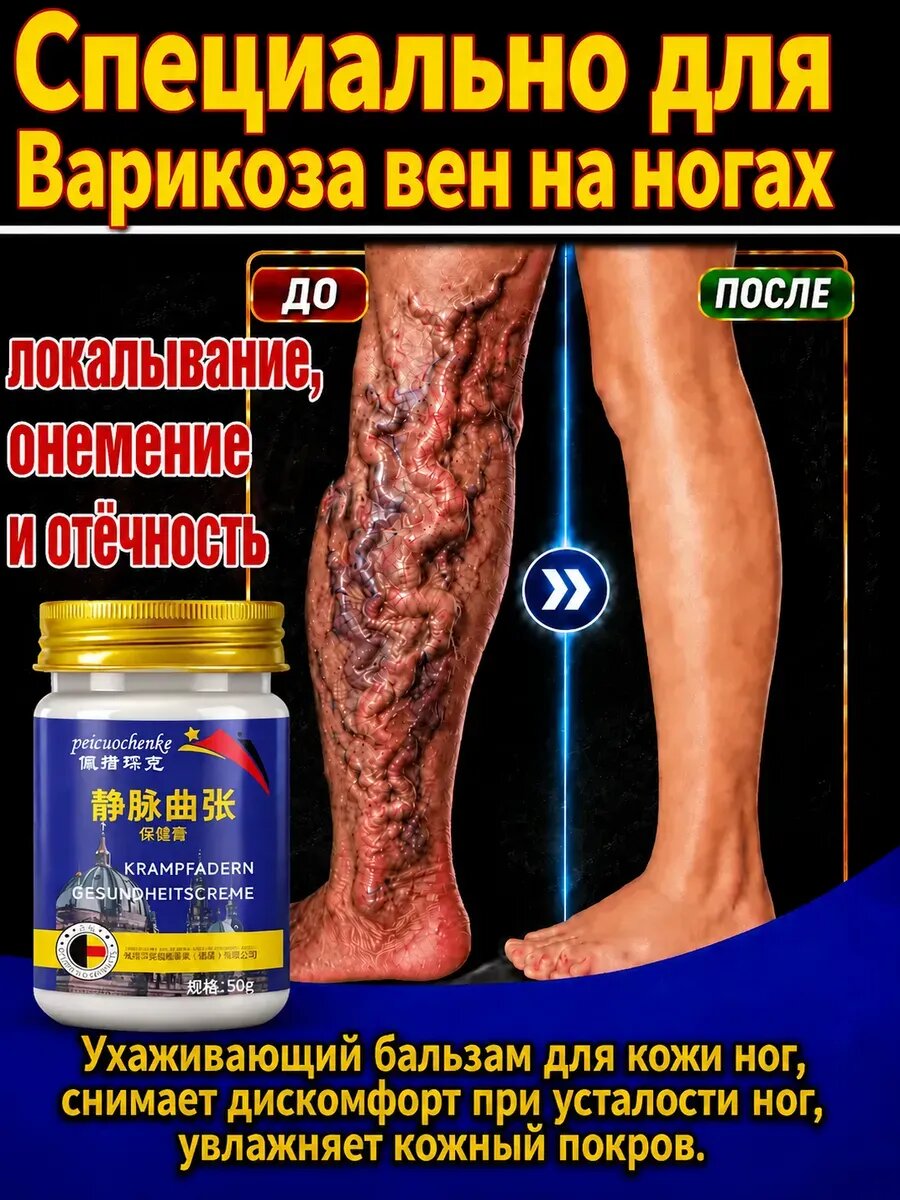 Мазь от варикоза вен на ногах
