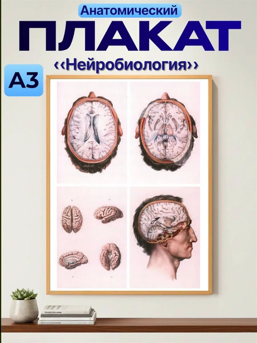 Постер медицинский, саг. мозг, нейробиология, нейрохирургия, А3 анатомия, хирургия