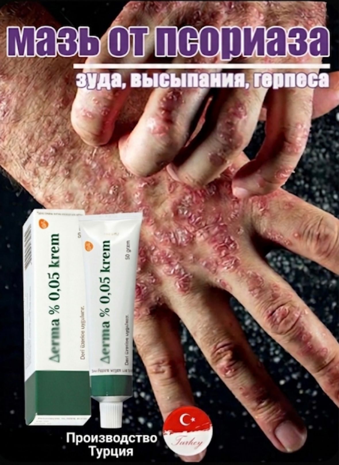 Крем от псориаза Турция