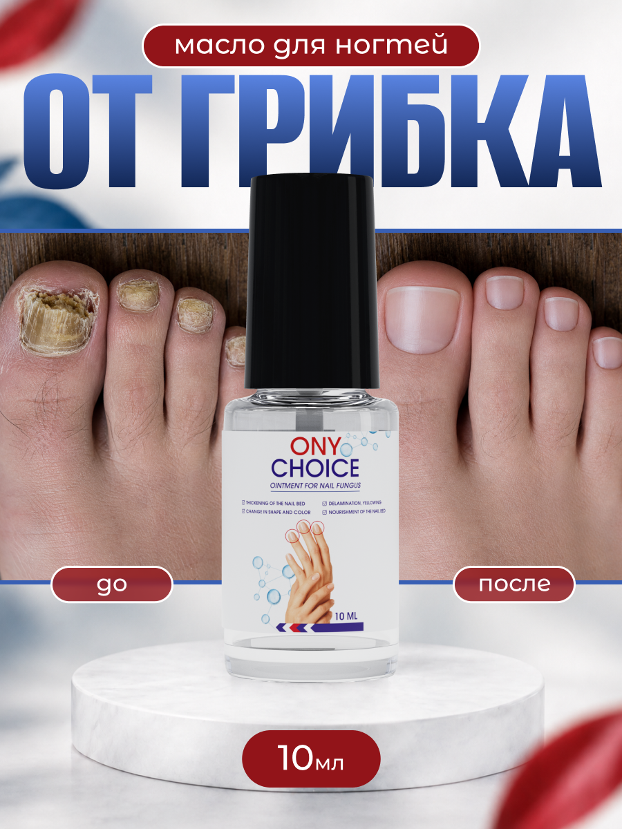 Лак для ногтей Nail Fungus, масло от грибка и онихолизиса, 10 мл