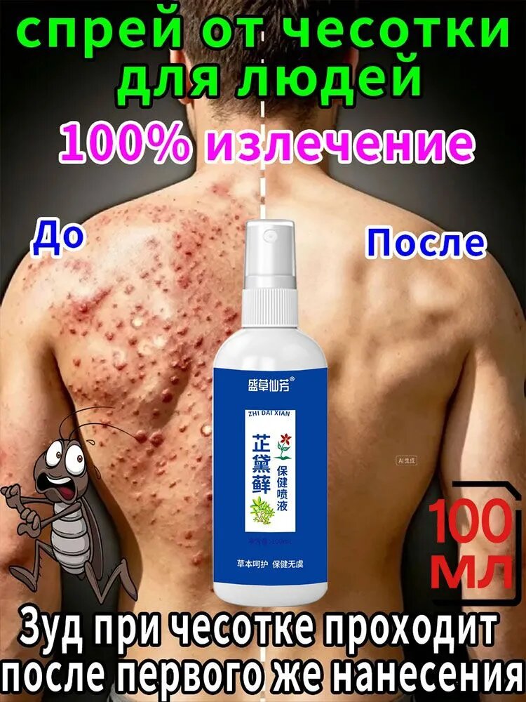 Китайская формула спрей от чесотки, псориаза, экземы и дерматита! Натуральное решение кожных проблем100 мл