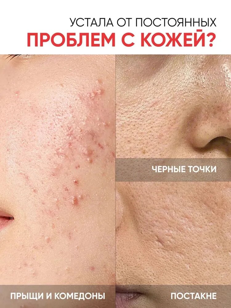 Пилинг для лица LEFAMI — фото 1