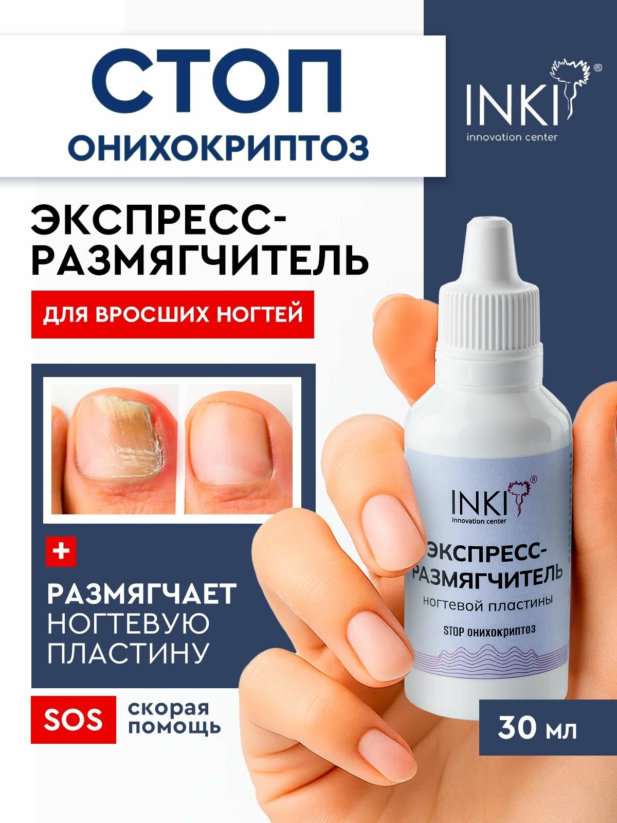 Размягчитель для вросших ногтей на ногах и руках 30 мл от вросших ногтей 30 мл для ног и рук