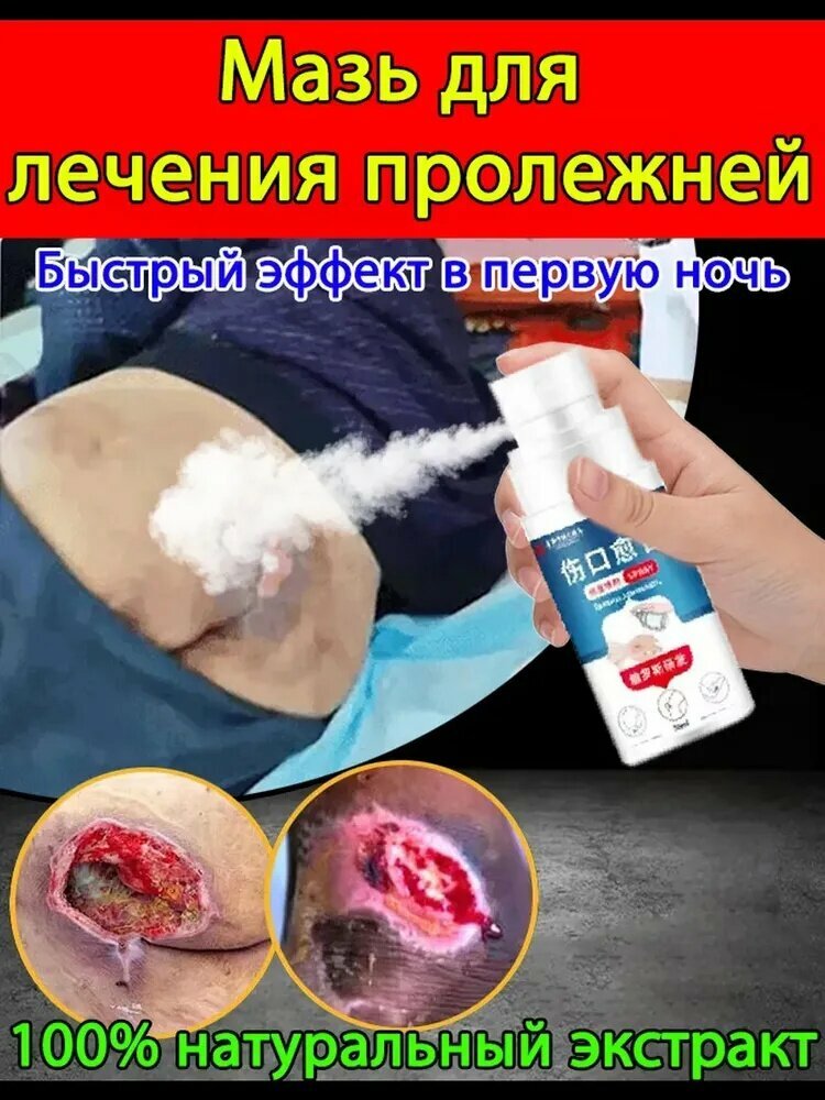 Средство от пролежней для лежачих больных, спрей для заживления ран, антибактериальный уход за кожей