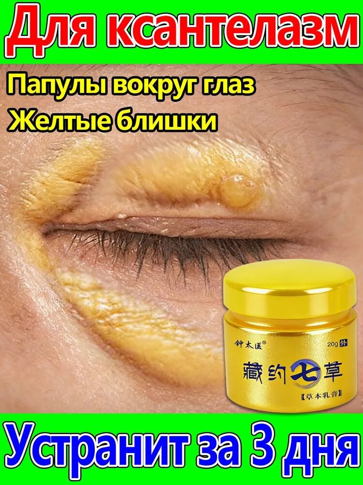 Мазь для лечения халязиона, удаления милиумов на веке и ксантелазмы комплексный уход за кожей вокруг глаз