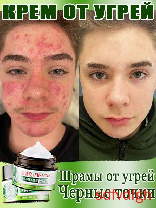 Салициловая мазь от прыщей, эффективно борется с воспалениями, направленная на акне и угри, прыщами и последствиями акне, подходит подросткам и проблемной коже, 30 г.